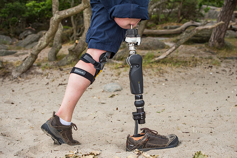 Complete Guide To Above Knee Prosthetics: Types, Process, And Benefits
